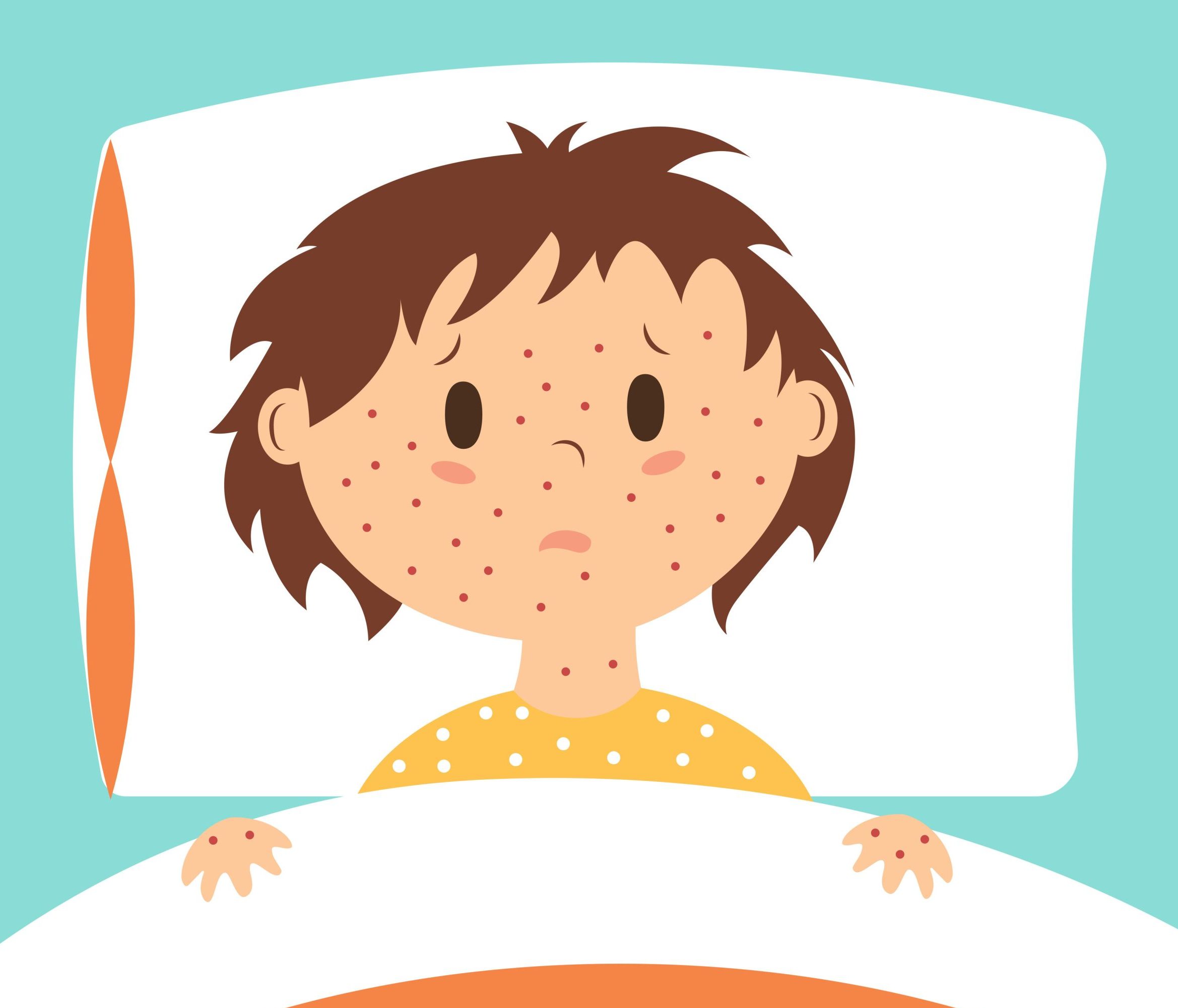 Rougeole : connaître les risques et se protéger - Hôpital de Montréal ...